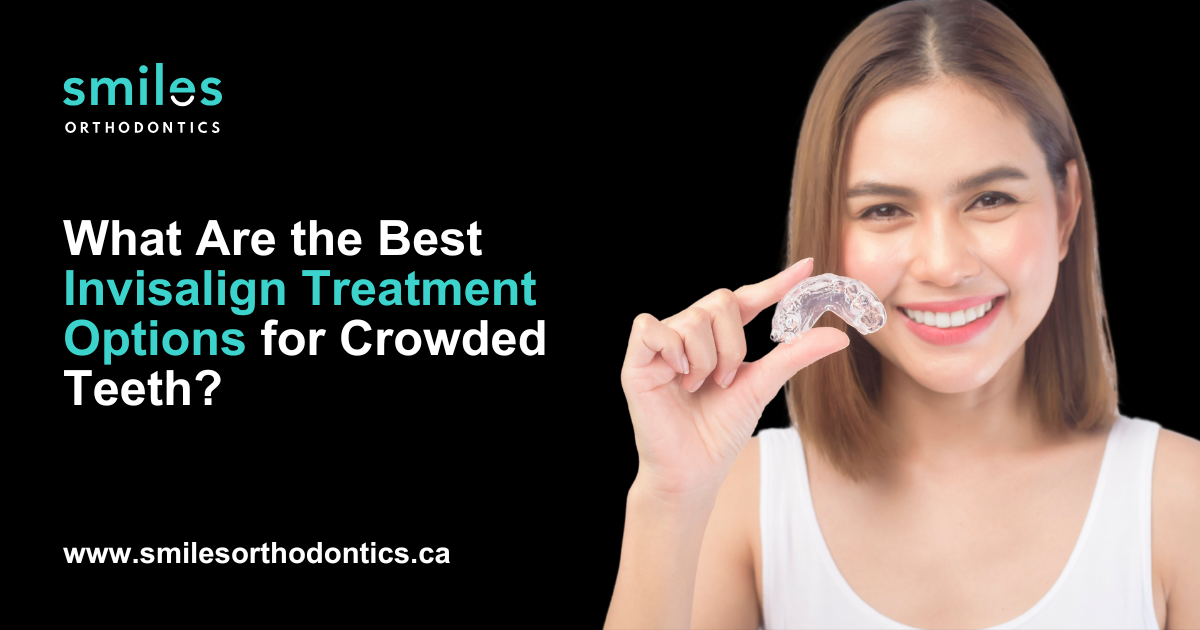 #1 Best Invisalign Treatment Options For Crowded Teeth